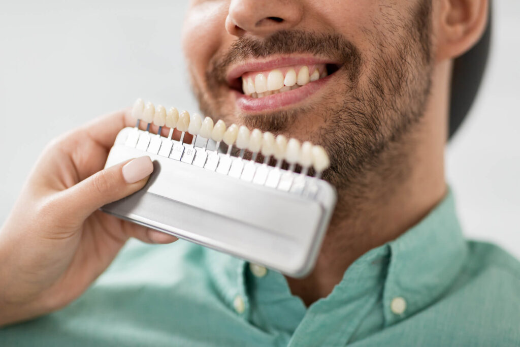What Are Veneers: Types, Benefits, Procedures & Results